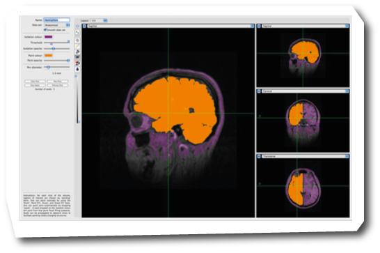 Brainsight TMS Navigation | Brainbox